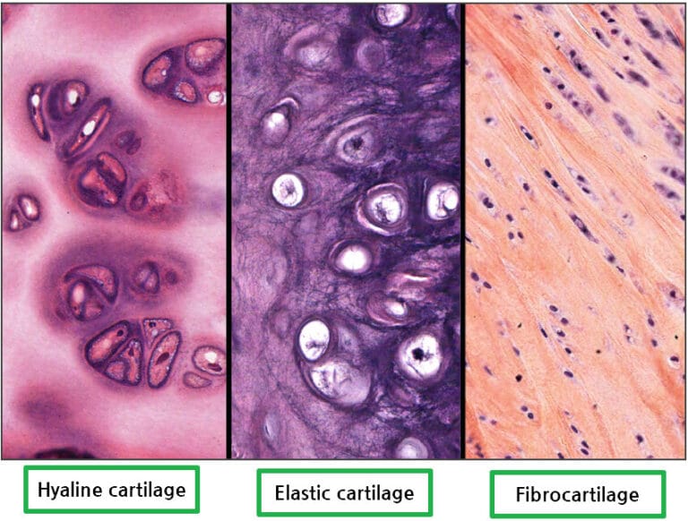 연골 (Cartilage) - 의학당