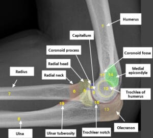 Elbow X-ray Anatomy - 의학당
