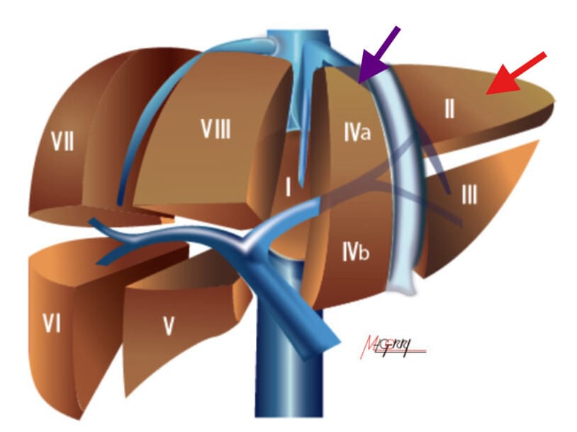 간의 분절 (Liver Segments - Couinaud System) - 의학당