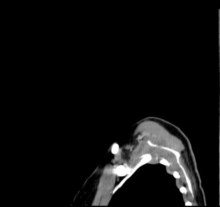 Neck CT Anatomy, Sagittal - 의학당